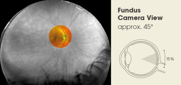 Optomap : Opula Opticians